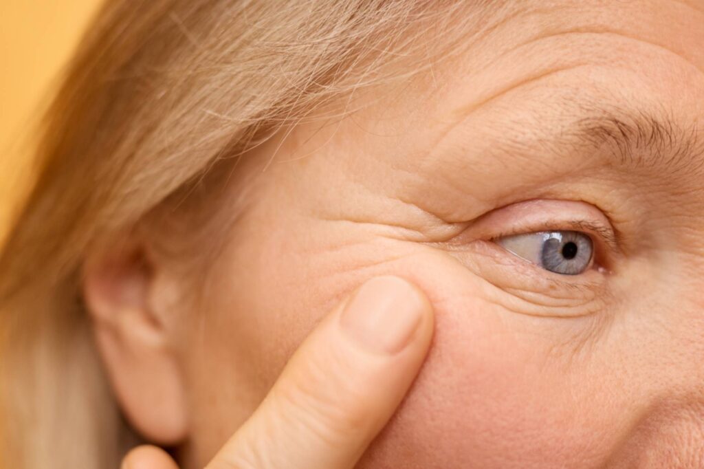 How to Smooth Fine Lines Around the Eyes Without Surgery